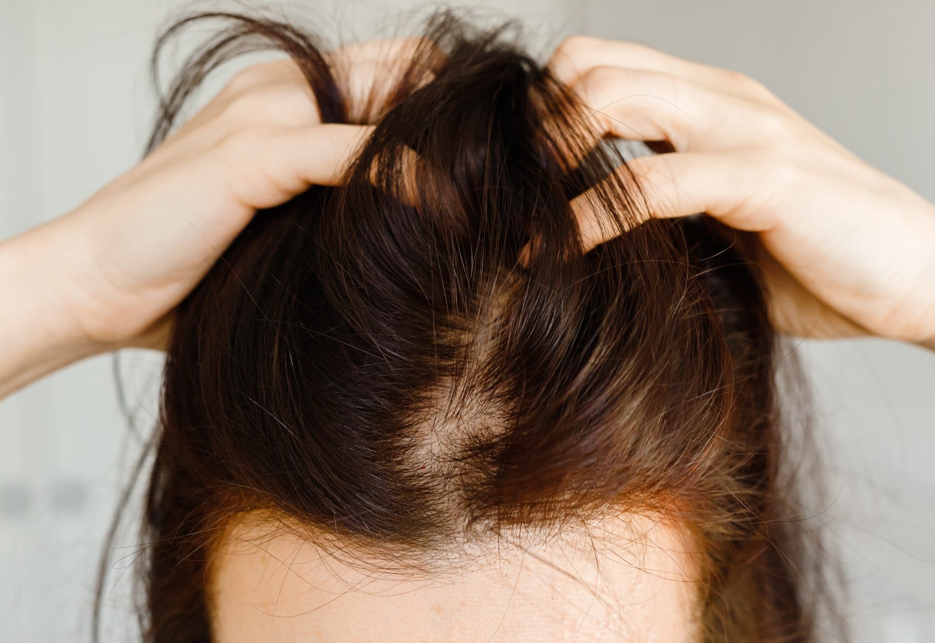 4 signs you're neglected your scalp & how to fix it with S$40