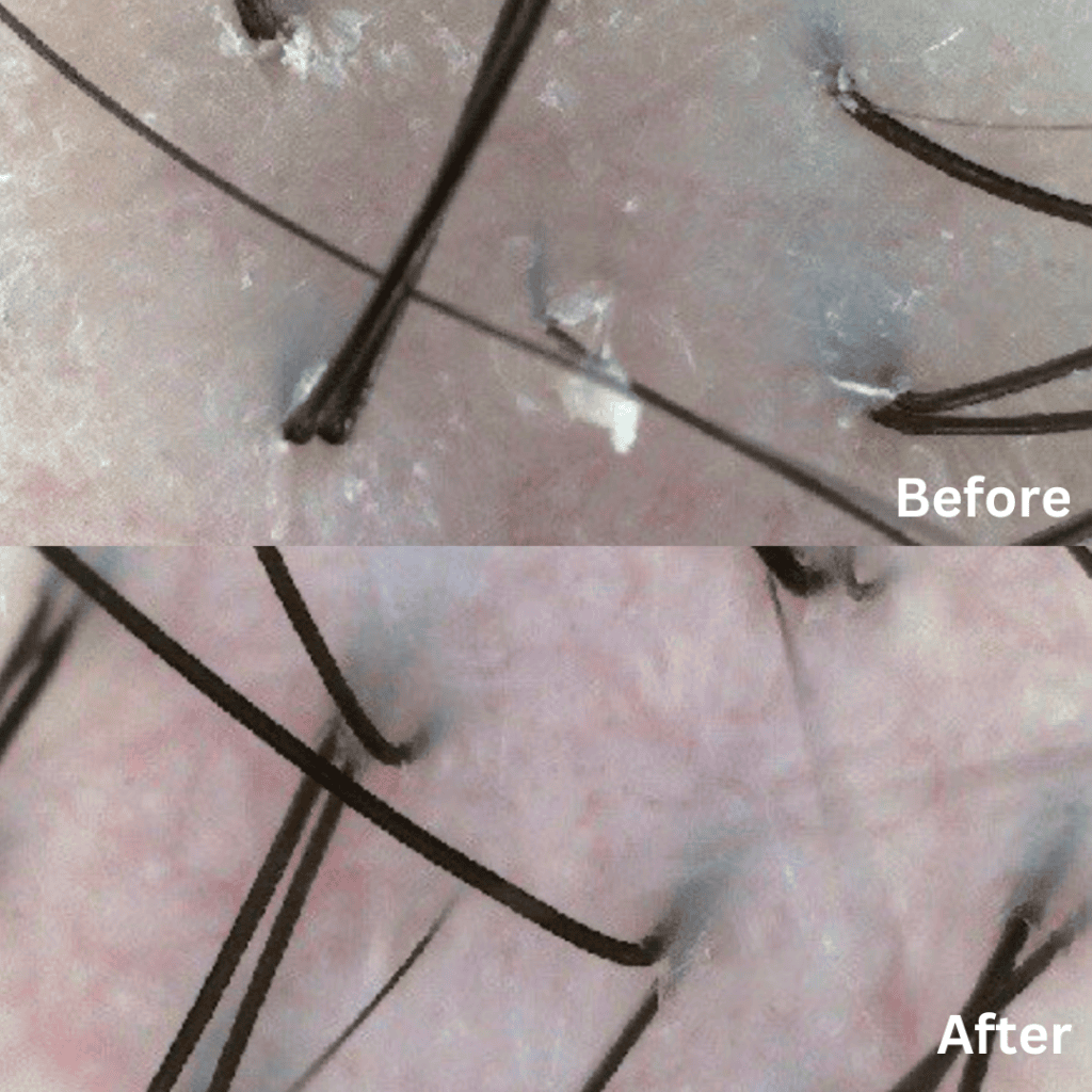 This scalp treatment is every gym-goer's best friend for better scalp