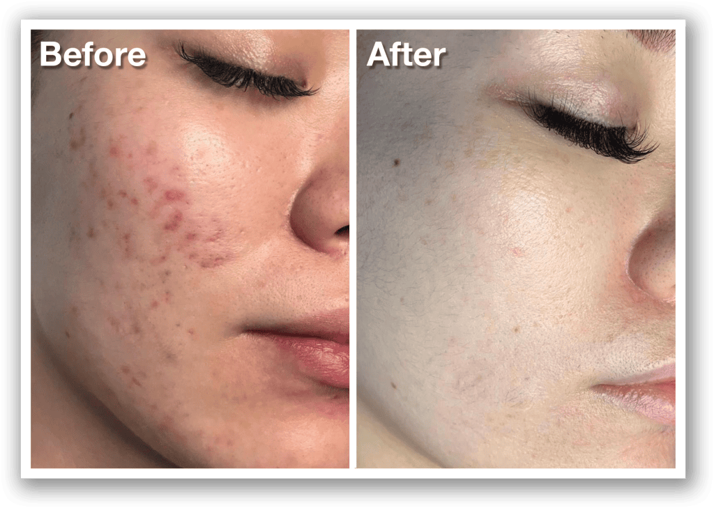 Elevate your skincare routine with these S$48 facial treatments